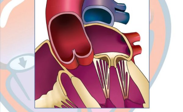 British Heart Valve Society – – Improve care for patients with valve ...
