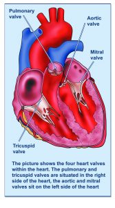 Valve replacement - British Heart Valve Society