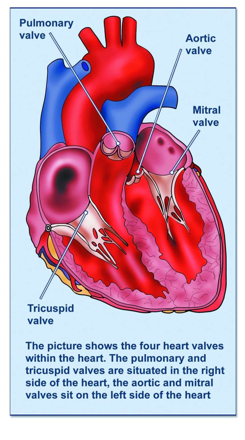 Heart valve surgery - British Heart Valve Society